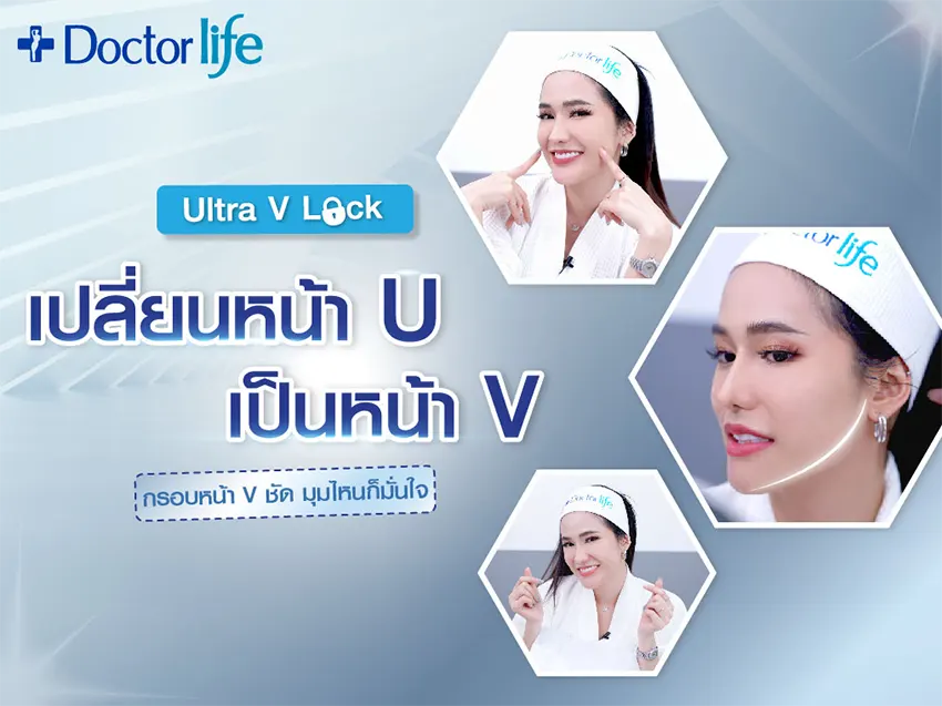 Ultra V Lock เปลี่ยนหน้า U เป็นหน้า V ยกกระชับกรอบหน้าชัด - Doctorlife ...